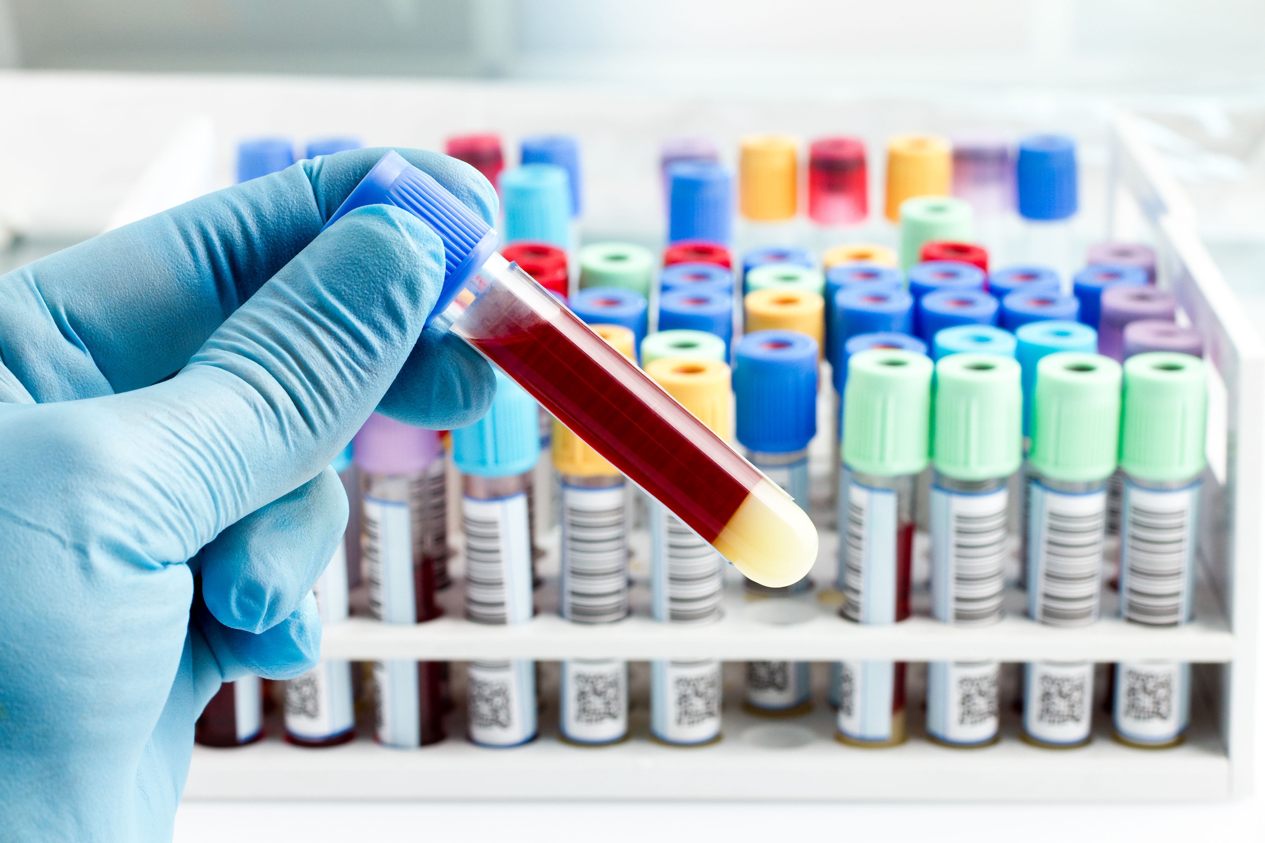 Functional Blood Work Assessment